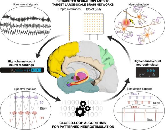 The 2026 Brain: Smarter, Faster, Stronger? - NewsBreak