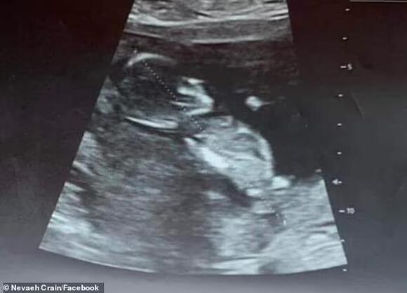 Pregnant teen died agonizing sepsis death after Texas doctors refused ...