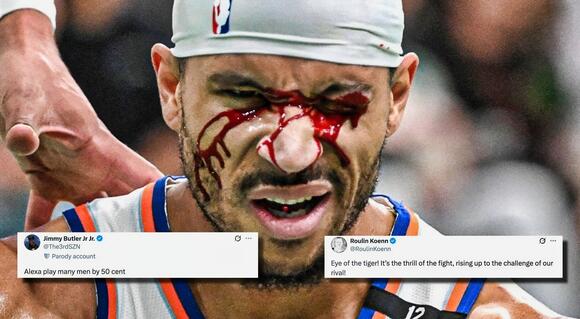 Social Media Had Plenty To Say As Josh Hart Bleeds Heavily After Taking Vicious Elbow To The ...