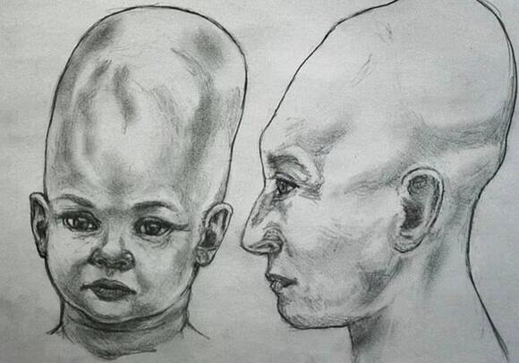 'Conehead humans' could be aliens as DNA tests leave scientists baffled ...