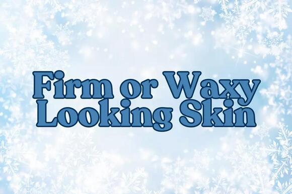 Every Michigander Should Know These Frostbite Warning Signs - NewsBreak