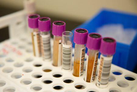Australia's CSL plans to invest $1.5 billion in US plasma therapy ...