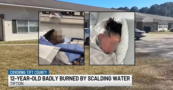 'He's numb about it': 12-year-old boy's friends allegedly dump scalding ...