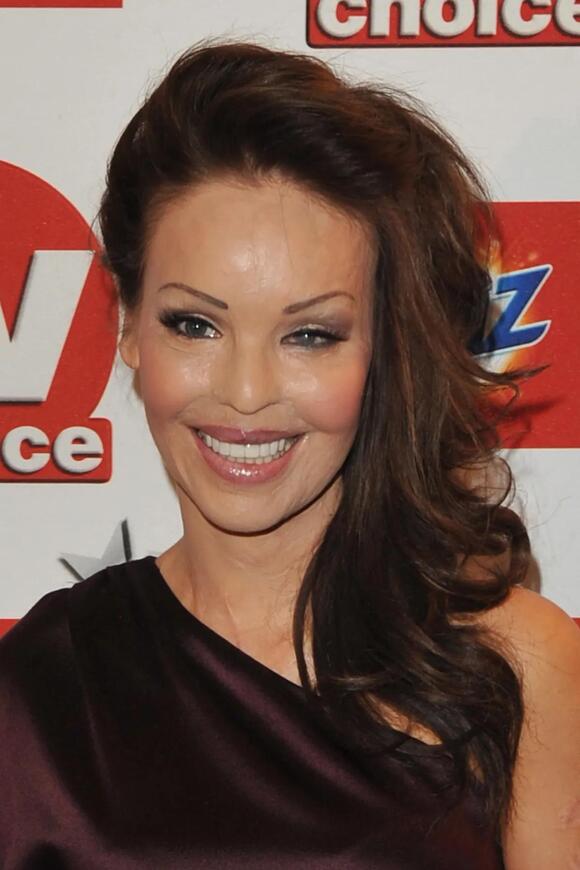 Katie Piper Reveals She Has Undergone Another Surgery - Video - NewsBreak