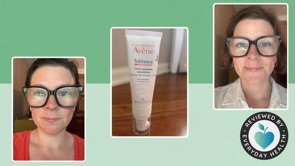 We Tested More Than 20 After-Sun Lotions - These Are the 9 Options We ...
