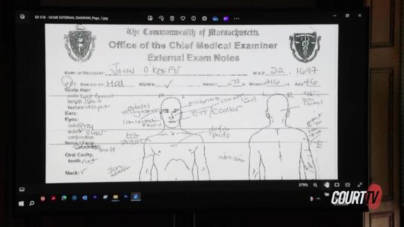 John O’Keefe Had Fractures to Ribs, Not Hands: Medical Examiner - NewsBreak