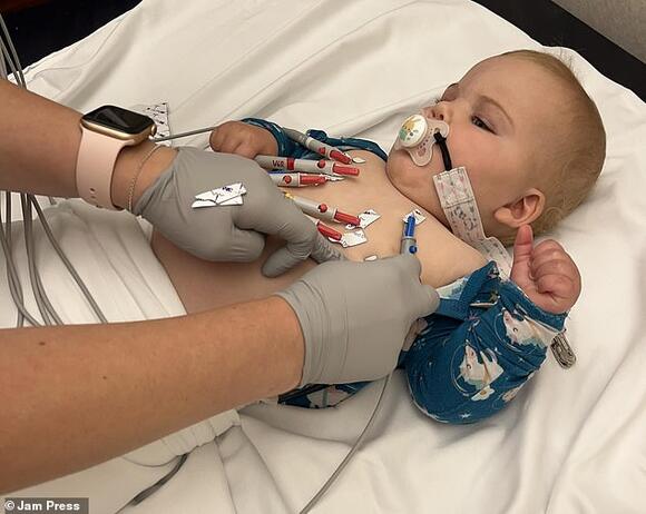 My baby will never walk or talk after being born with rare brain ...