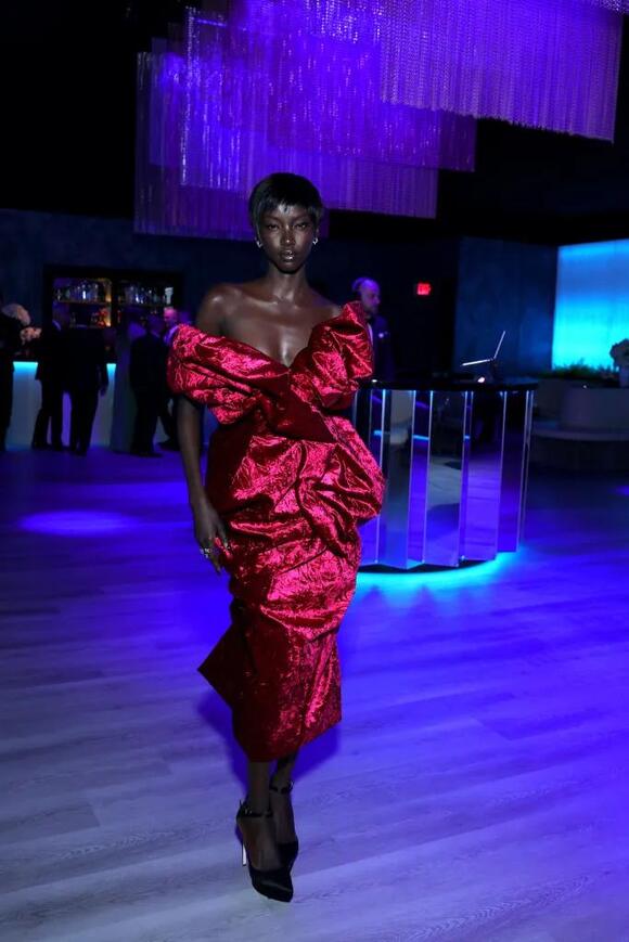 Get Well Soon: Model Anok Yai Reveals Surgery For Congenital Condition That Was ‘Destroying’ Her ...