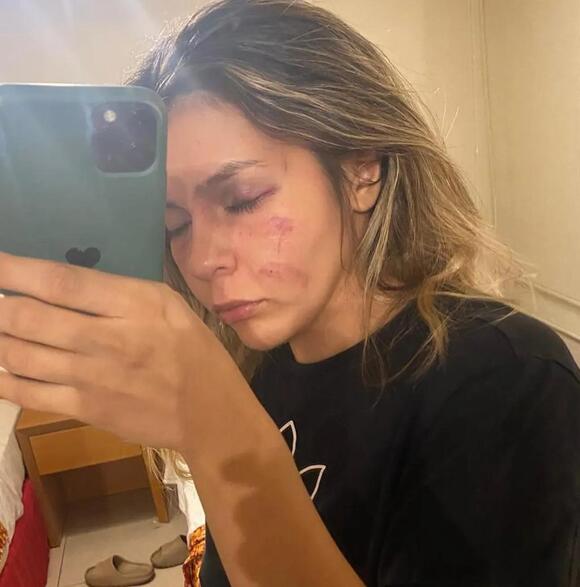 Boxer Brianda Tamara recalls nightmare Imane Khelif fight with bruise ...