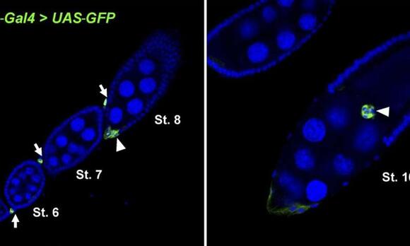 Extra sets of chromosomes may help aggressive tumor cells spread, study ...
