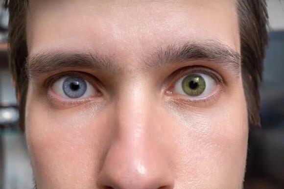 What Is the Rarest Eye Color? Discover Why Only 2% of People Are Born ...