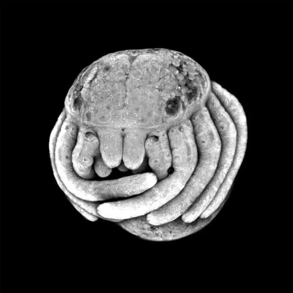 Reddit can't look away from this alien-like spider embryo inside its ...