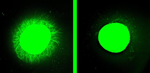 Lab-Grown “Mini” Human Spinal Cords Healed In Major Step Towards ...