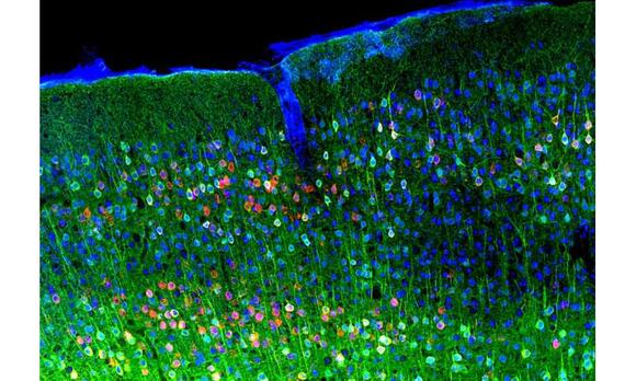 Seeing is believing: Smart probes reveal proteins inside living cells ...