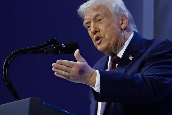 Trump’s Bulging Cankles Exposed by Podcaster - NewsBreak