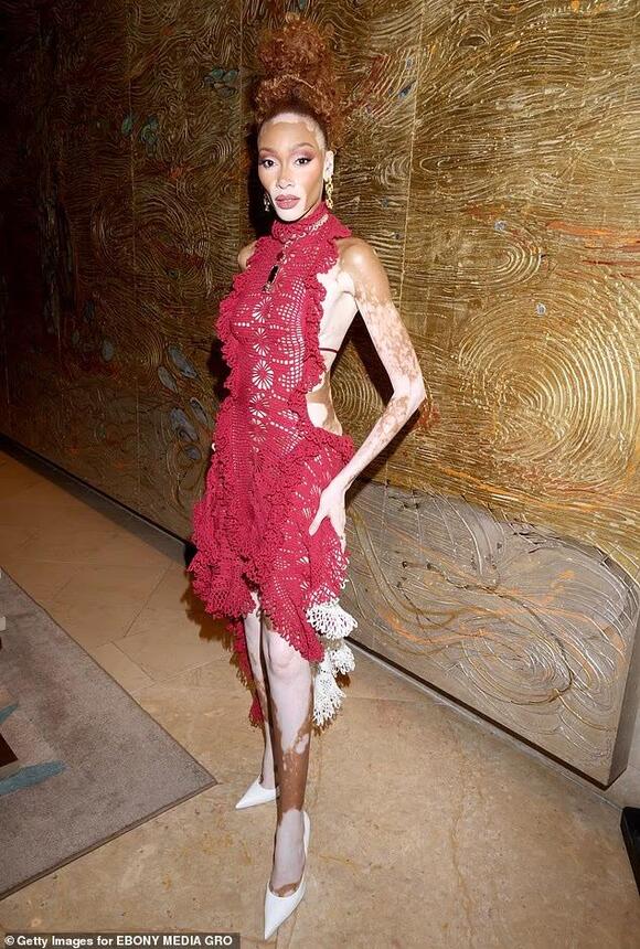 Winnie Harlow leads the red carpet glamour in a stunning backless gown ...
