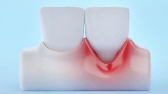 Brushing With Your Opposite Hand Helps Stop Receding Gums + More ...