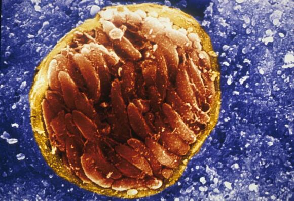 Cat parasite infecting third of humans is ‘major cause of vision loss ...