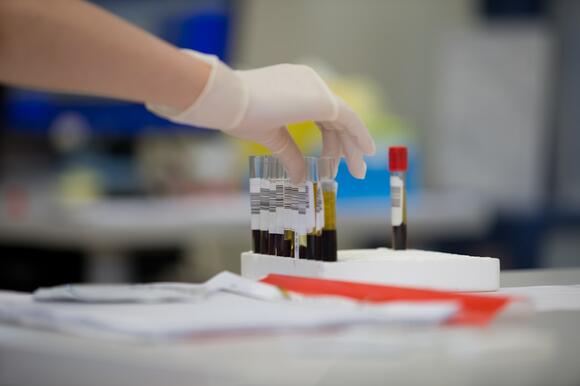 The Alien Blood Type: How the Rare Rh-Negative Blood Has Sparked Myths ...