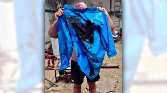 Man hospitalized with serious injuries after boxing-style fight with ...