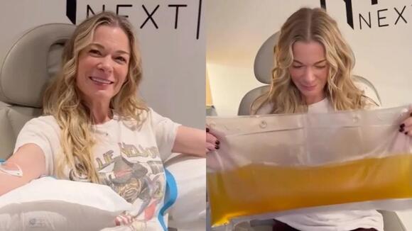 LeAnn Rimes Undergoes $10,000 Plasma Treatment After Teeth Fell Out ...