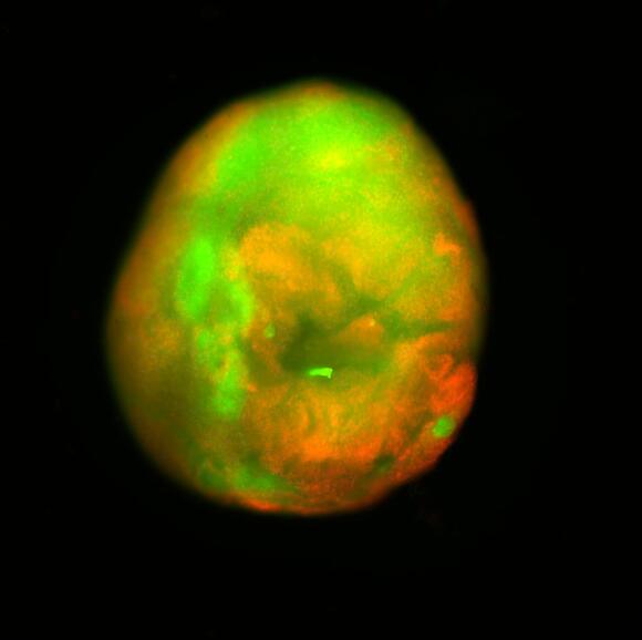 Lab-Grown “Mini” Human Spinal Cords Healed In Major Step Towards ...