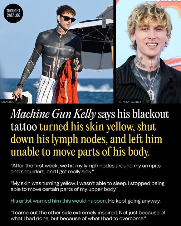 Machine Gun Kelly Says His Blackout Tattoo Turned His Skin Yellow, Shut ...