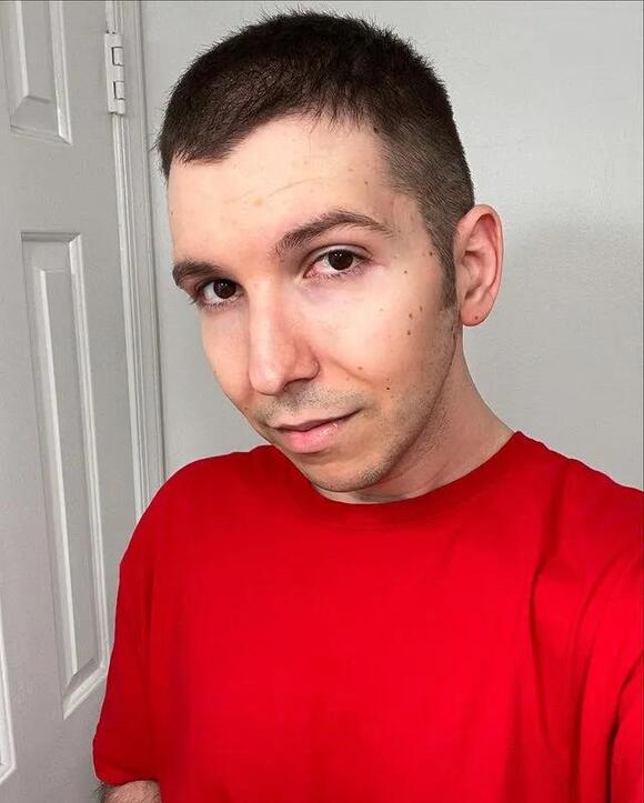 Nikocado Avocado’s new YouTube video reveals skinny face & 250lb weight ...