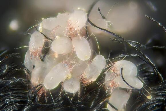 Why Your Dead Skin Is Still Full of Life — Microscopic Life, That Is ...
