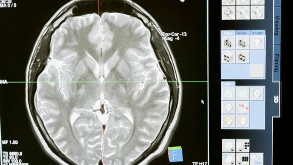 Evangeline Lilly Reveals Brain Damage After Freak Accident - NewsBreak