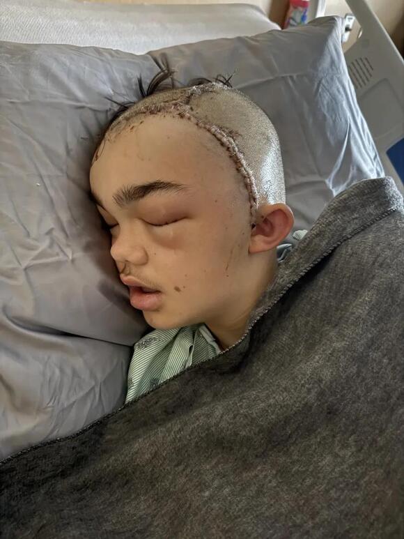 Parents speak out after Texas middle schooler suffers skull fracture in ...