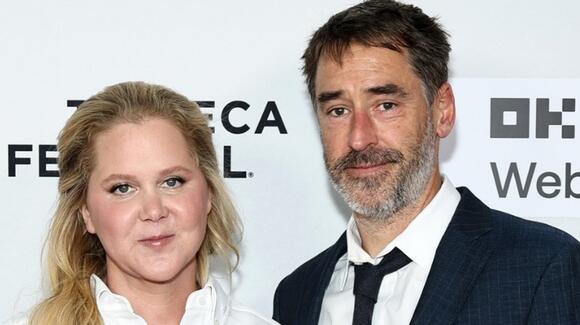 Before & After Pics Of Amy Schumer Make Her 'Ozempic Face' Obvious ...