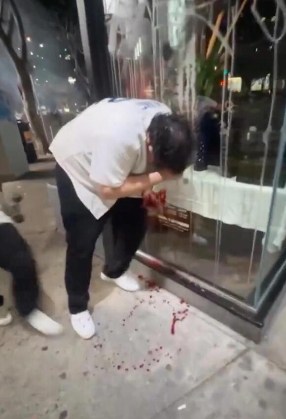 Dodgers fan, 25, blows up hands with firework while celebrating World Series win over Yankees ...