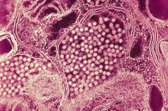 Map reveals areas most at risk of EEE infection as deadly mosquito ...