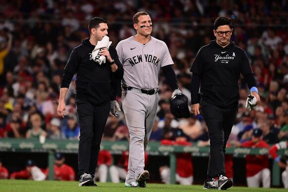 Anthony Rizzo out 4 to 6 weeks with fractured arm in Yankees’ injury ...