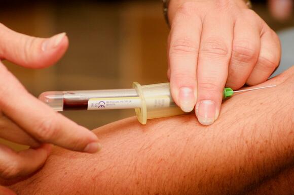 The Alien Blood Type: How the Rare Rh-Negative Blood Has Sparked Myths ...