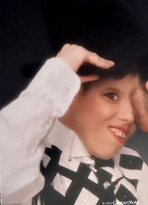 World’s oldest conjoined twins, Lori and George Schappell, dead at 62 ...