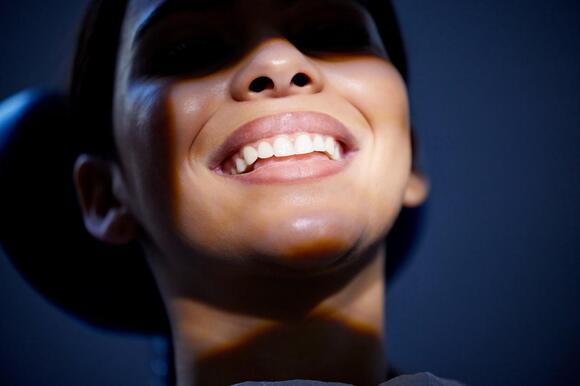 ‘Veneer Breath’ Is Plaguing People With Perfect Smiles - NewsBreak