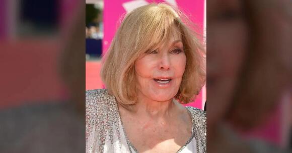 EXCLUSIVE: Kim Novak's Plastic Surgery Disaster — Top Doc Warns Screen ...