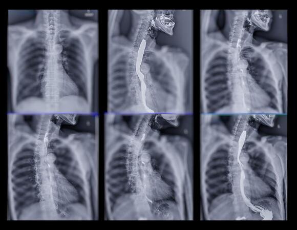 So THAT'S Why Your Stomach Hurts More As You Get Older - NewsBreak
