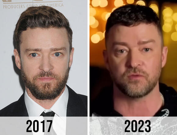 Fans Think Justin Timberlake Had 'Bad Plastic Surgery' After His ...