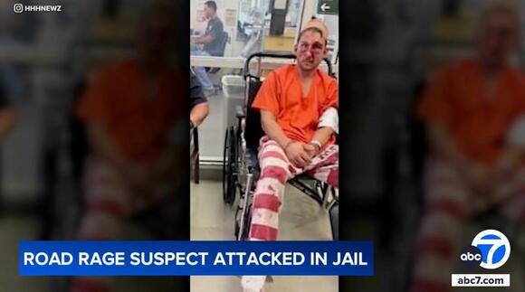 Serial Tesla road-rager beaten to a bloody pulp in prison after he’s ...