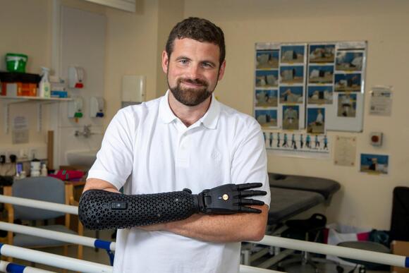 Amputee farmer receives new super advanced bionic arm - NewsBreak