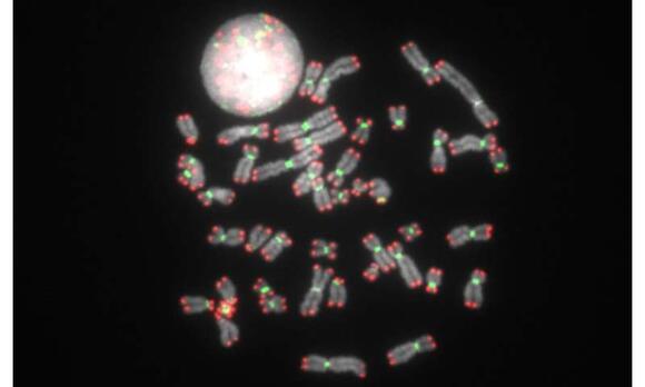 Loss of DNA protector gene exposes vulnerabilities in cancerous cells ...
