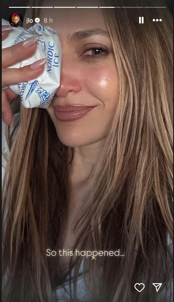 Jennifer Lopez gives health update after onstage injury that led to ...