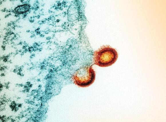Africa’s First HIV Cure Trial Offers Hope 20% of Patients Remain Drug ...