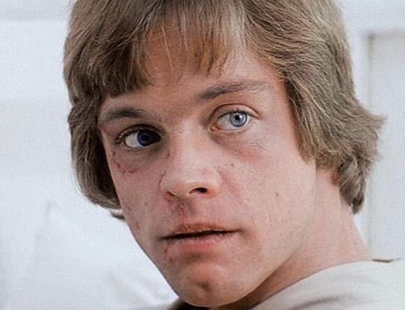 Famous Actors With Scars, And How They Got Them - NewsBreak