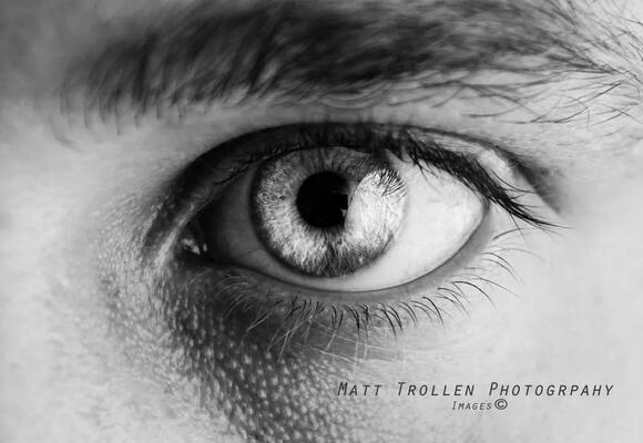 Living on Air: How the Cornea Survives Without a Direct Blood Supply ...