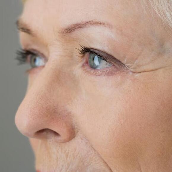 A Board-Certified Derm Reveals The Worst Causes Of Wrinkles And Crow’s ...