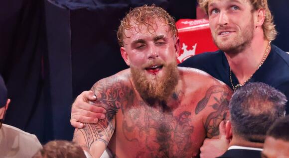 Shocking Images Of Jake Paul’s Swollen Face Leak Online After Anthony ...